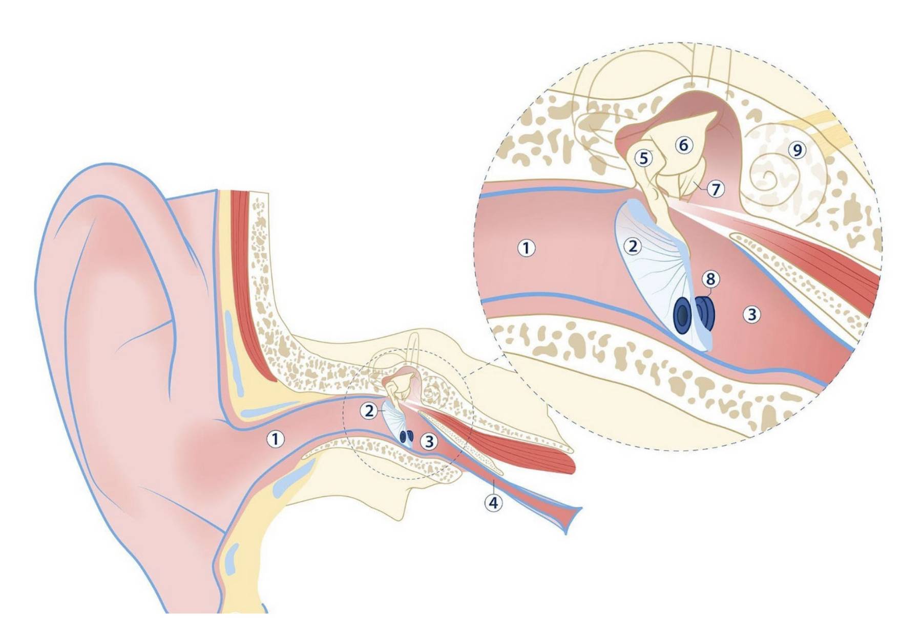 Oreja de pegamento | Centro Médico Teknon