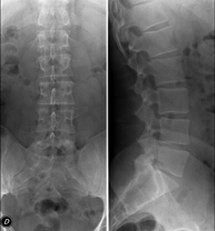 RX Seriada ósea | Centro Médico Teknon