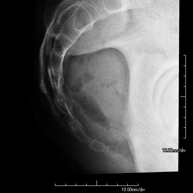 RX Sacro-cóccix | Centro Médico Teknon