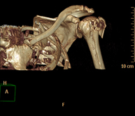 Shoulder CT | Centro Médico Teknon